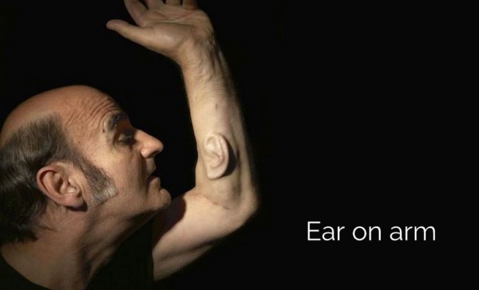 Man Grows Ear on Arm, Plans to Connect it to the Internet