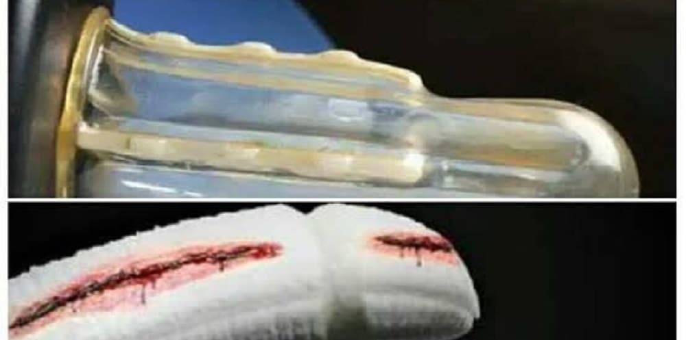 These Female Condoms With "Teeth" Can Prevent Rape (VIDEO)